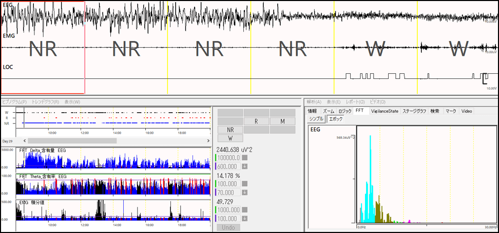 SleepSign（睡眠解析研究用プログラム） | キッセイコムテック株式会社